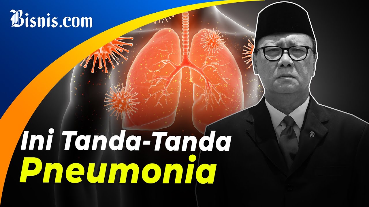 Kenali Gejala Pneumonia atau Infeksi Paru-Paru
